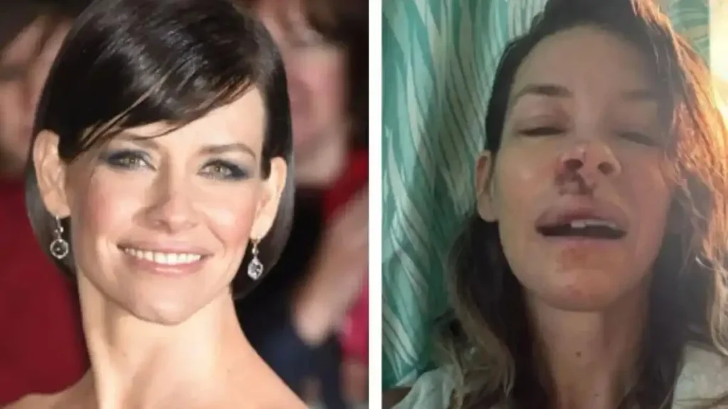 Evangeline Lilly enfrenta un diagnóstico de daño cerebral tras un ...